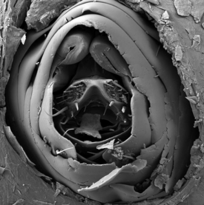 Tunga penetrans: Get to know Colombia’s least favourite skin-burrowing ...